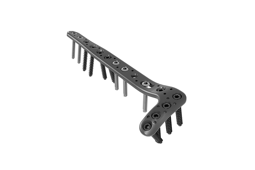 Distal Anterolateral Tibia Locking Plate (DTL) | ITS Implant - EN
