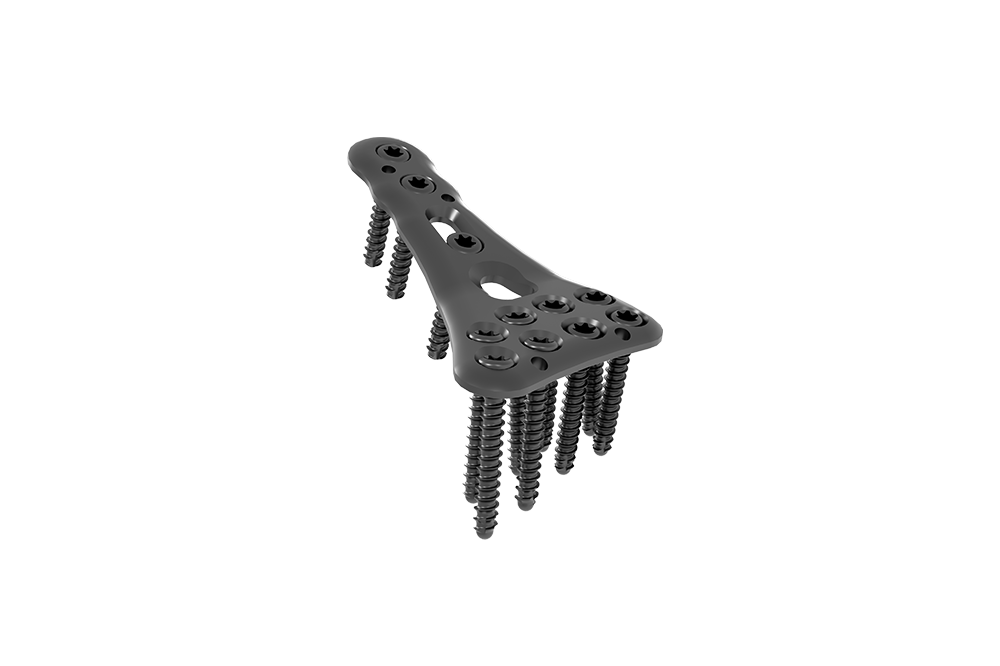 PROlock Radius Locking Plates (PRLP) | ITS Implant - EN
