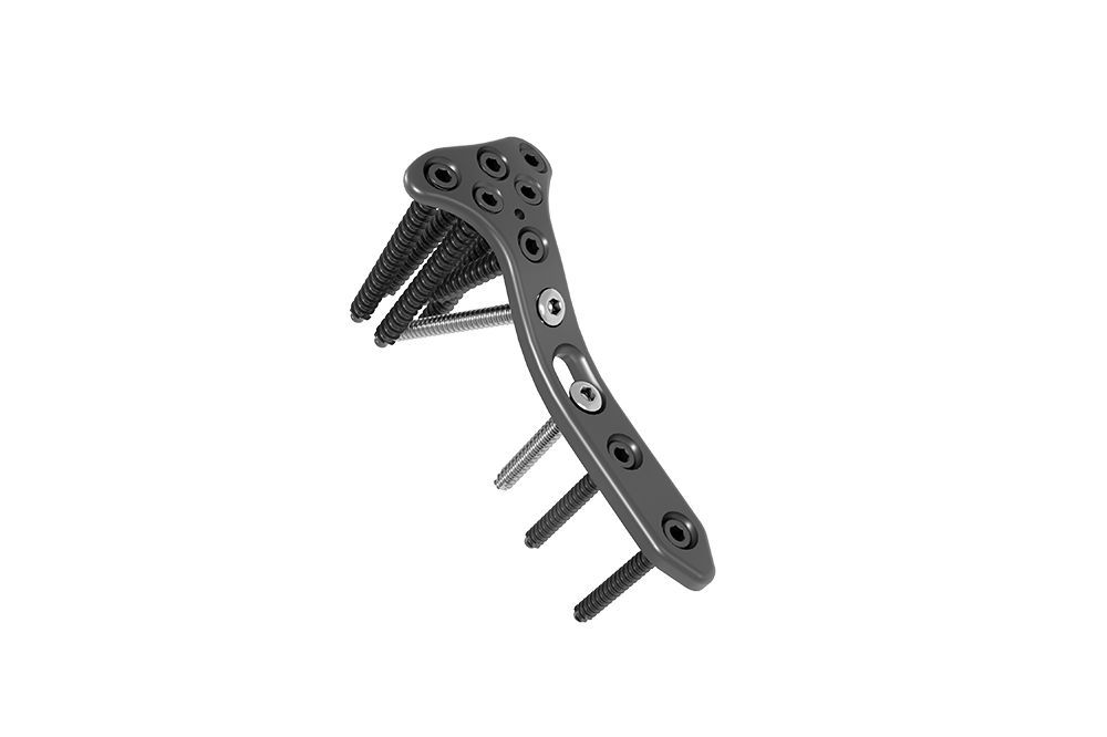 Proximal Medial Tibia Locking Plate (PROMET) | ITS Implant - EN