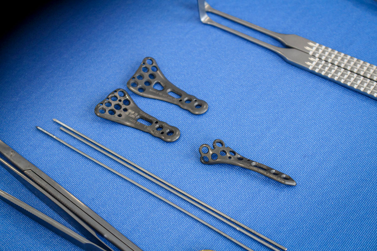 PROlock Radius Locking Plates (PRLP) | ITS Implant - EN