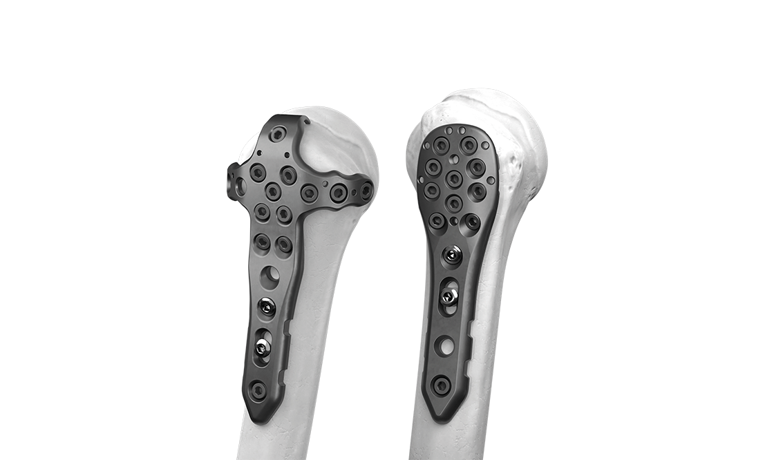 ITS Implant - EN | Pioneers For Orthopaedic Implants