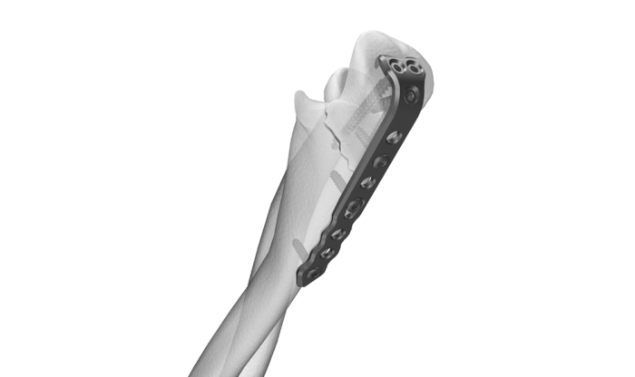 Products | ITS Implant - EN