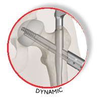 HIP-G | ITS Implant - USA