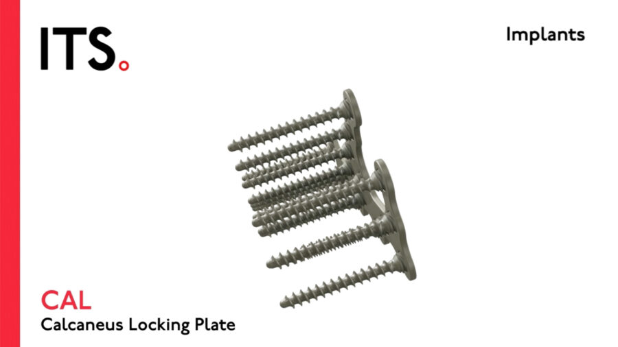 Calcaneus Locking Plate (CAL) | ITS Implant - USA